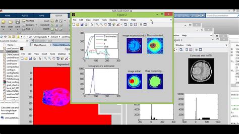 MATLAB Code Brain Tumor Segmentation Using CNN YouTube