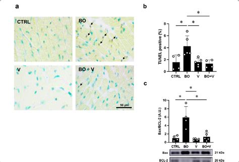 Effect Of Vidarabine On Bo Induced Cardiac Myocyte Apoptosis A