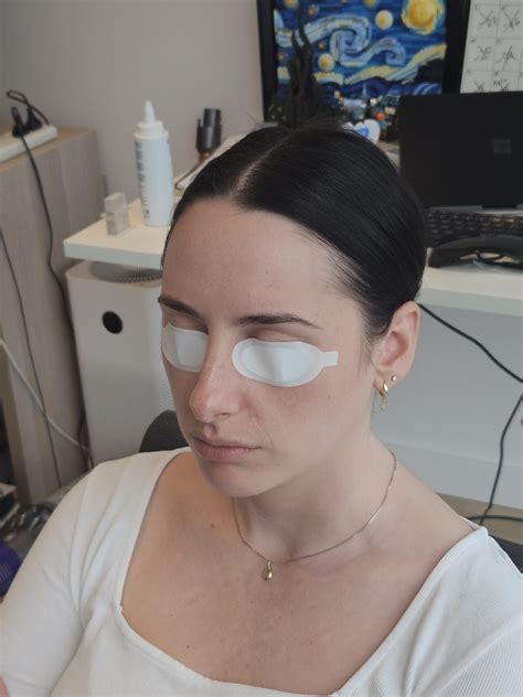 Dry Eyes Eyecare Project