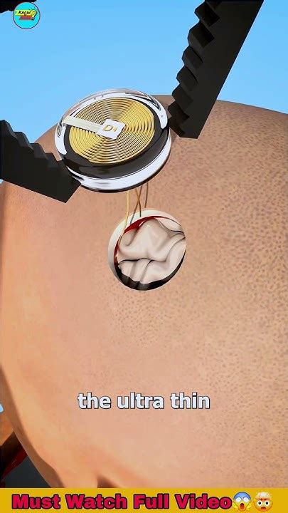 How Neuralink Works Explain In 3d Animation Shortvideo Youtube