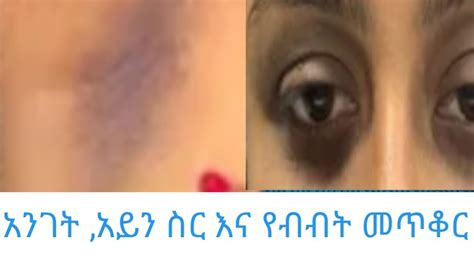 አንገት አይን ስር እና ብብት መጥቆር መፍትሄ Youtube