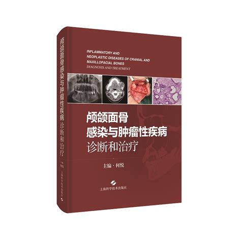 颅颌面骨感染与肿瘤性疾病诊断和治疗何悦口腔科学书籍颅颌面骨常见病检查诊疗手术操作上海科学技术出版社9787547854884虎窝淘