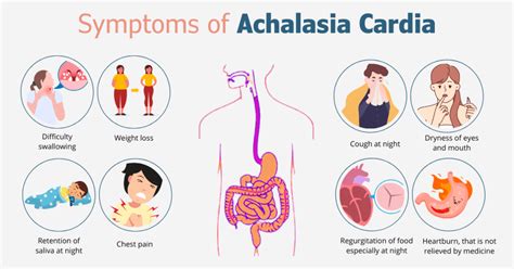 Esophageal Achalasia Symptoms Diagnosis Treatment