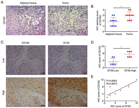 Expression Levels Of Stx6 And Cd163 In Hcc A Cd163 Expression In Hcc