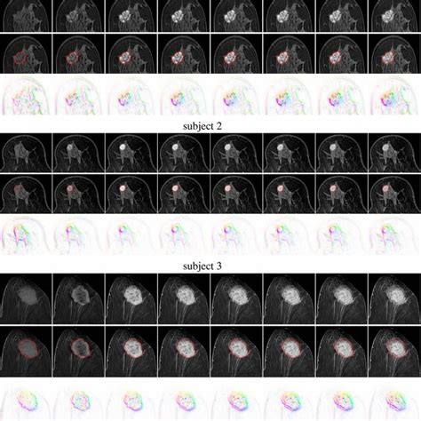 Each Block Of Three Row Images Presents Top Example Slices Of Dce Download Scientific Diagram