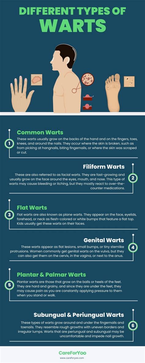 Tips For Dealing With Unsightly Warts Hip Girlie