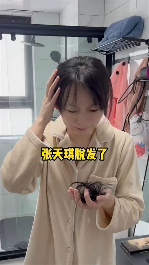 张天琪这发量，还能坚持多久高清1080p在线观看平台腾讯视频