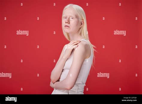 Portrait Of Albino Girl With Unusual Appearance And Natural Beauty