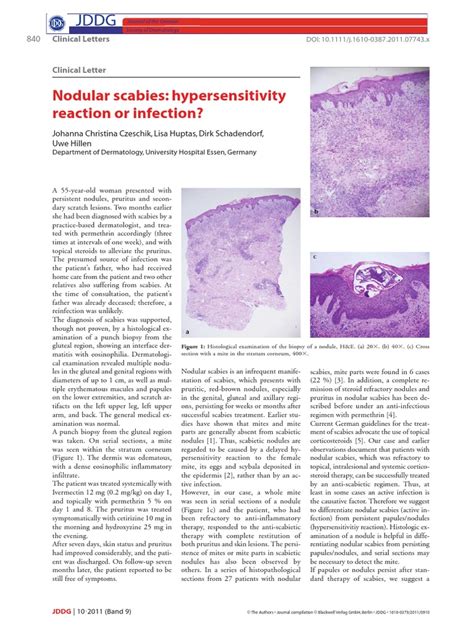 Jddg Nodular Scabies Dermatology Immunology
