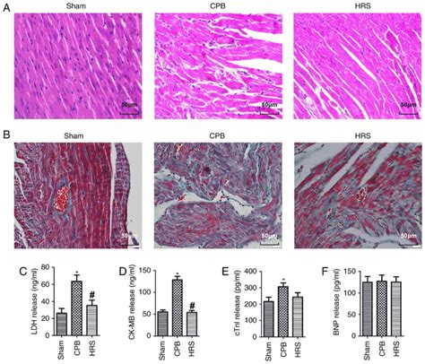 Hydrogenrich Solution Against Myocardial Injury And Aquaporin