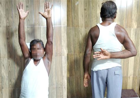 Abduction And Internal Rotation Movements At 5 5 Years Postoperatively