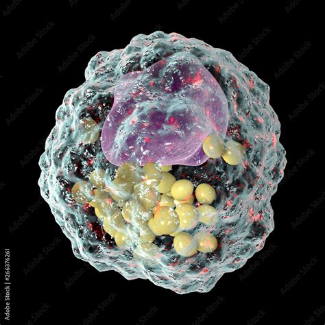 Foam Cell A Macrophage Cell With Lipid Droplets Stock Illustration