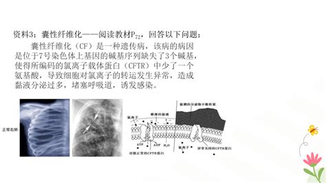 42 基因表达与性状的关系 课件(共21张ppt)21世纪教育网 二一教育 42 基因表达与性状的关系 课件(共21张ppt)21世纪教育网 二一教育