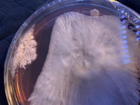 Looking At My Contaminated Agar Plates R Contamfam