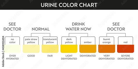 Urine Color Hydration Chart Illustration Of Bladders Vrogue Co