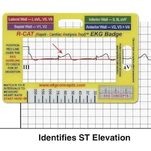 R CAT For Arrhythmias EKG Pocket Reference Guide Plus EKG Badge Great Study Card For ECG