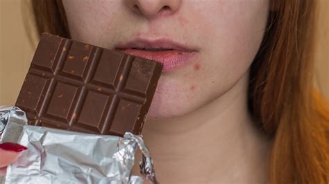 Can Sugar Cause Acne I Is God