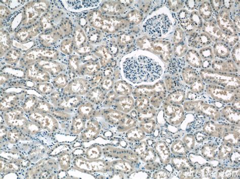 Ap1m2 Antibody 10618 1 Ap Proteintech