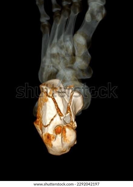 Ct Scan Ankle Joint 3d Rendering Stock Illustration 2292042197