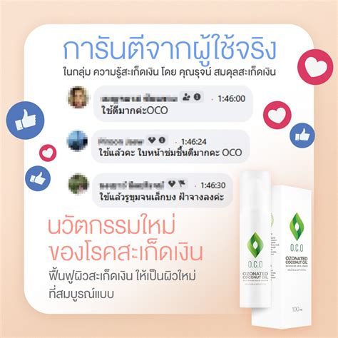ยาทาสะเก็ดเงินไม่มีสเตียรอยด์ทางเลือกใหม่ที่คุณไม่ควรมองข้าม Empowerlife