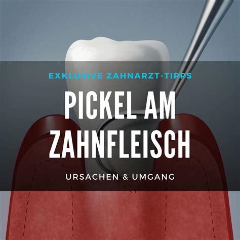 Pickel Am Zahnfleisch Ursachen And Umgang