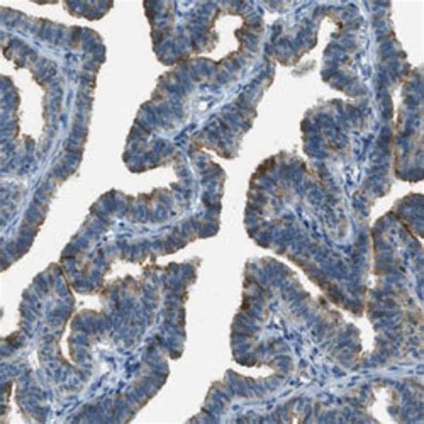 msln rabbit anti human polyclonal antibody abnova 100μl