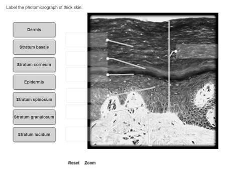 Solved Label The Photomicrograph Of Thick Skin Dermis Stratum Basale