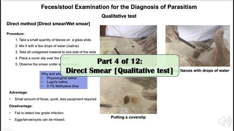 Part 4 Direct Smear Of Faces Or Stool For The Diagnosis Of Parasitism