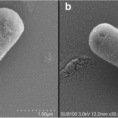 The Morphology Of B Cereus By Scanning Electron Microscope Analysis