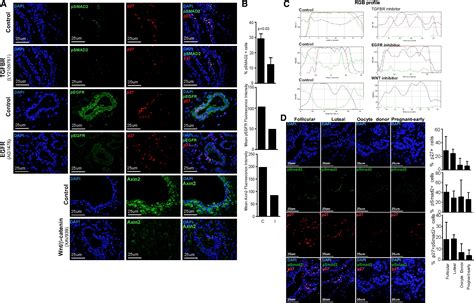 Molecular Profiling Of Human Mammary Gland Links Breast Cancer Risk To