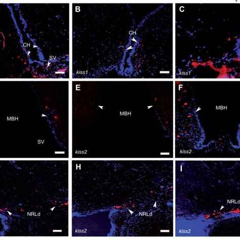 Huvec Proliferation Assay 5000 Huvecs Were Seeded At 96 Well Plate And Download Scientific