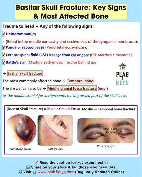 Plab 1 Keys √ You Can Access All Notes And Summaries For All Chapters And Recalls [topic Wise
