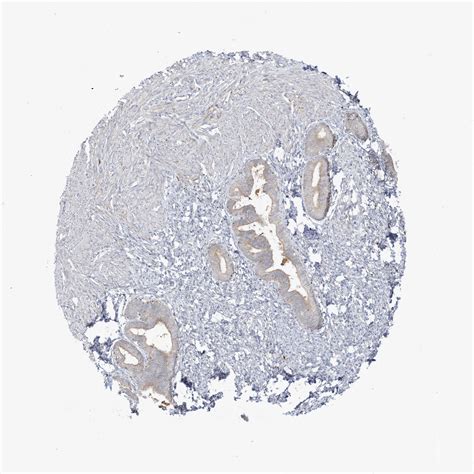 Tissue Expression Of Nppc Staining In Endometrium The Human Protein