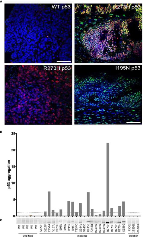 A Comparison Of Four Technologies For Detecting P53 Aggregates In