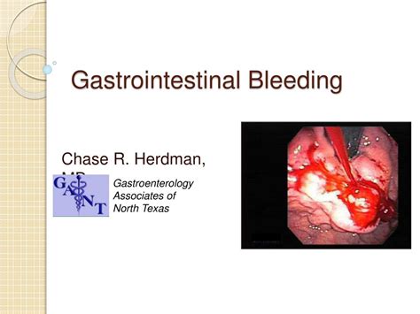 Ppt Gastrointestinal Bleeding Powerpoint Presentation Free Download
