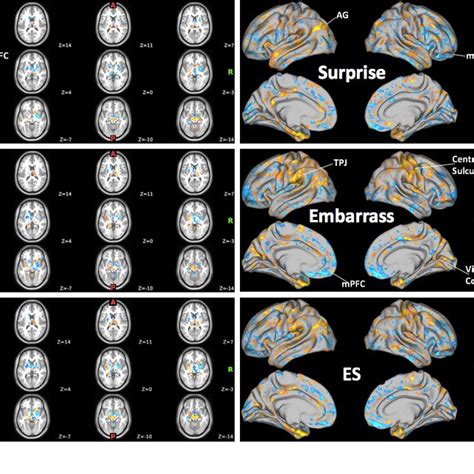 Fmri Theory Of Mind Ftom Task Brain Activation Cohend Maps