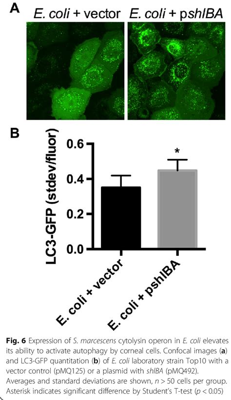 Abbreviations 3ma 3 Methyladenine Autophagy Inhibitor Anova