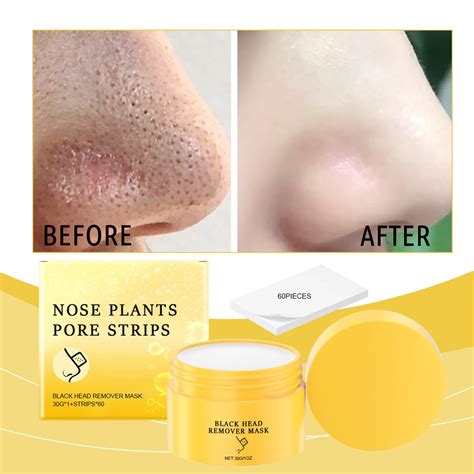Pore Strips Blackhead Remover Blackhead With 60 PCS Strips Black Head ...
