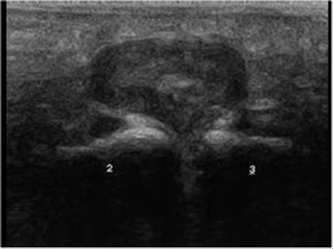 Musculoskeletal Joints And Tendons 6 8 Foot Case 6 8 4