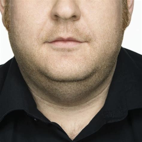 Fda Approves Treatment For Double Chins Health And Sports News