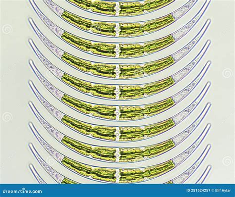 Closterium Sp Charophyta Algae Under Microscopic View X40 Green Algae