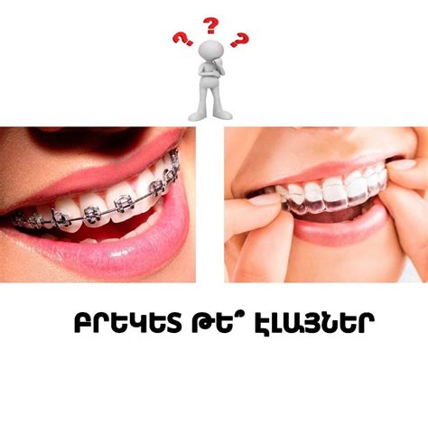 Dr Anahit Hakobyan 👩🏻‍⚕️Ցանկանում ե՞ք ունենալ անկաշկանդ ժպիտ ⁣ 👩🏻‍⚕️