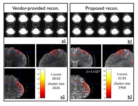 Comparison Of The Motor Task Activation Maps Obtained From Mb3ry2 Data
