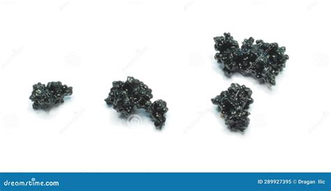 Gallstones Stock Image Image Of Bile Abdominal Iron 289927395