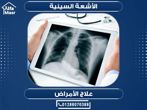 الأشعة السينية X Ray علاج الأمراض ألفا مصر للأشعة المنزلية