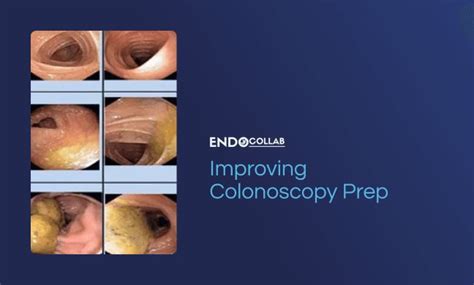 Endocollab™ Gi Endoscopy Education On Linkedin Bot Verification
