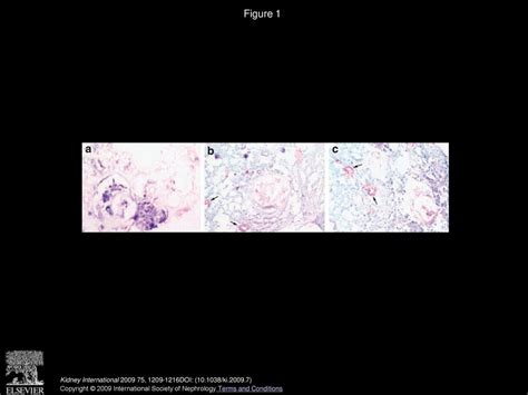 Detergent Resistant Globotriaosyl Ceramide May Define Verotoxin