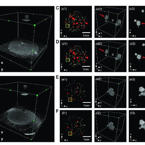comparison of the 3d segmentation results of unidirectional prediction