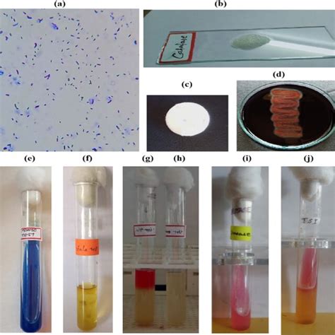 A Phylogenetic Tree Showing The 16s Rrna Sequence Similarity Of B Download Scientific