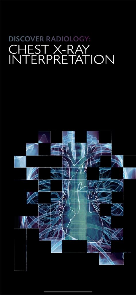 Chest X Ray Interpretation Reviews Revenue And Downloads Apple App Store India